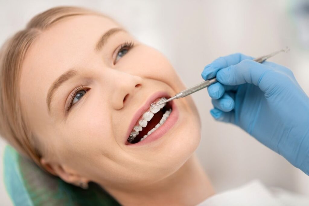 What to Expect After Braces Removal | Post-Braces Care Explained